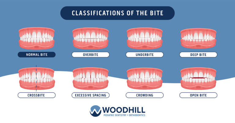 Can Braces or Clear Aligners Help Improve My Malocclusion? • Woodhill ...